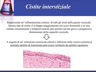 The cystitis | PPTX