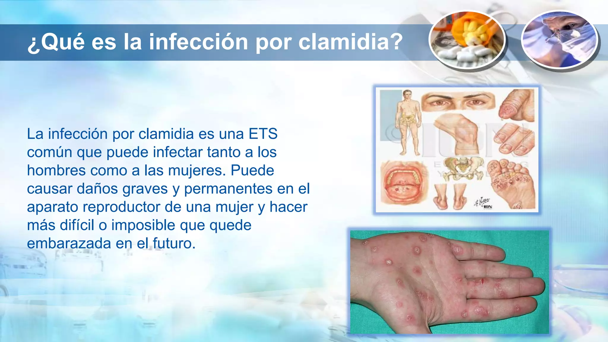 La clamidia | PPTX | Reproductive Health | Diseases and Conditions