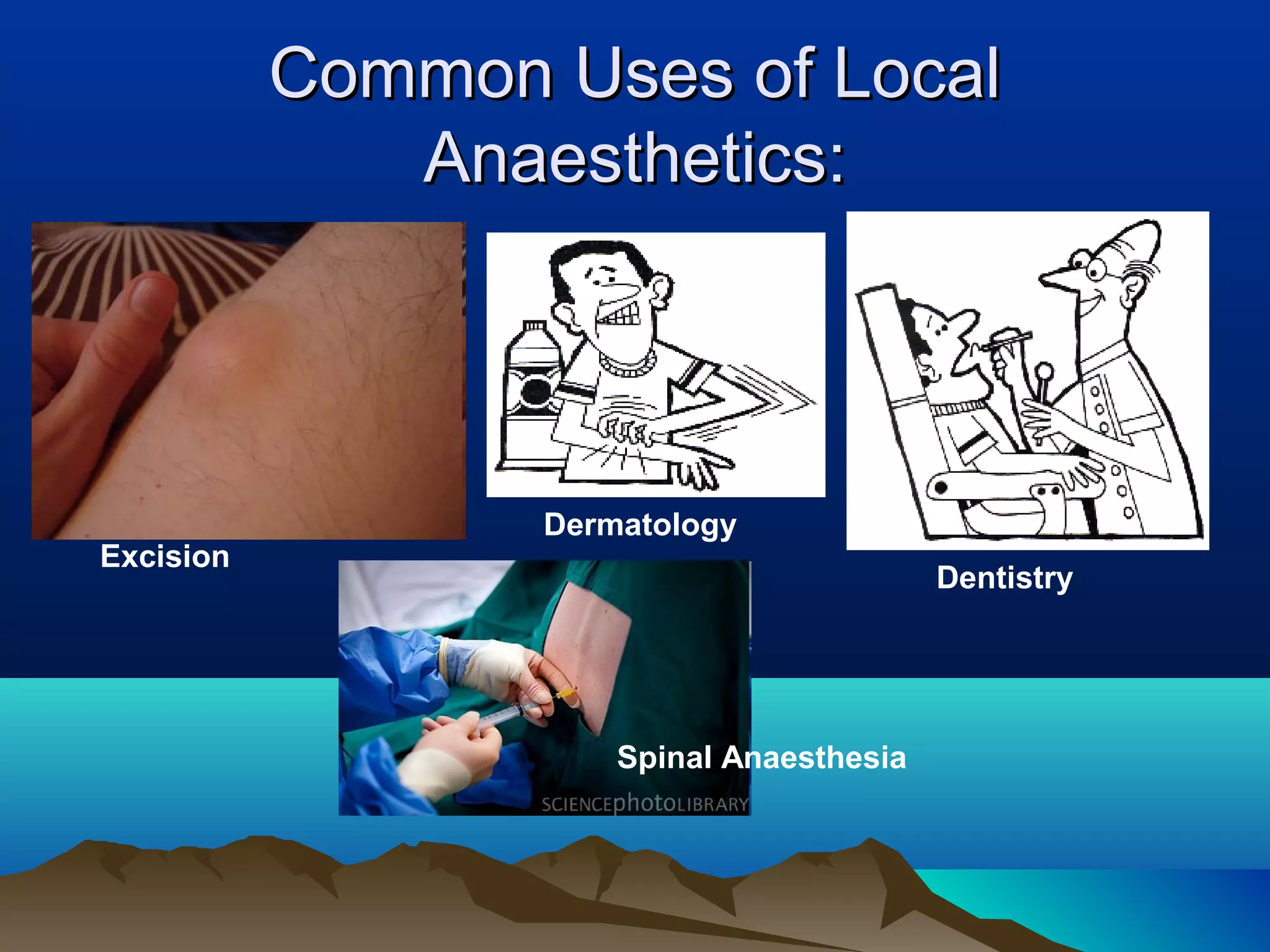 Local Anaesthetics | PPT