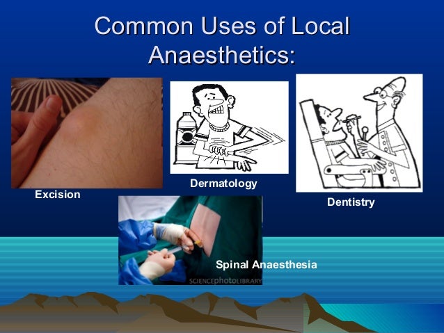Local Anaesthetics