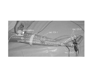 Lac mac and pac | PPTX