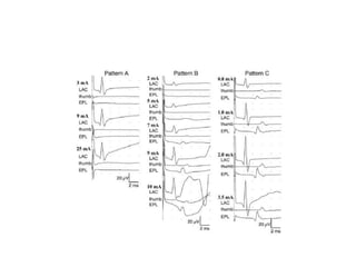 Lac mac and pac | PPTX