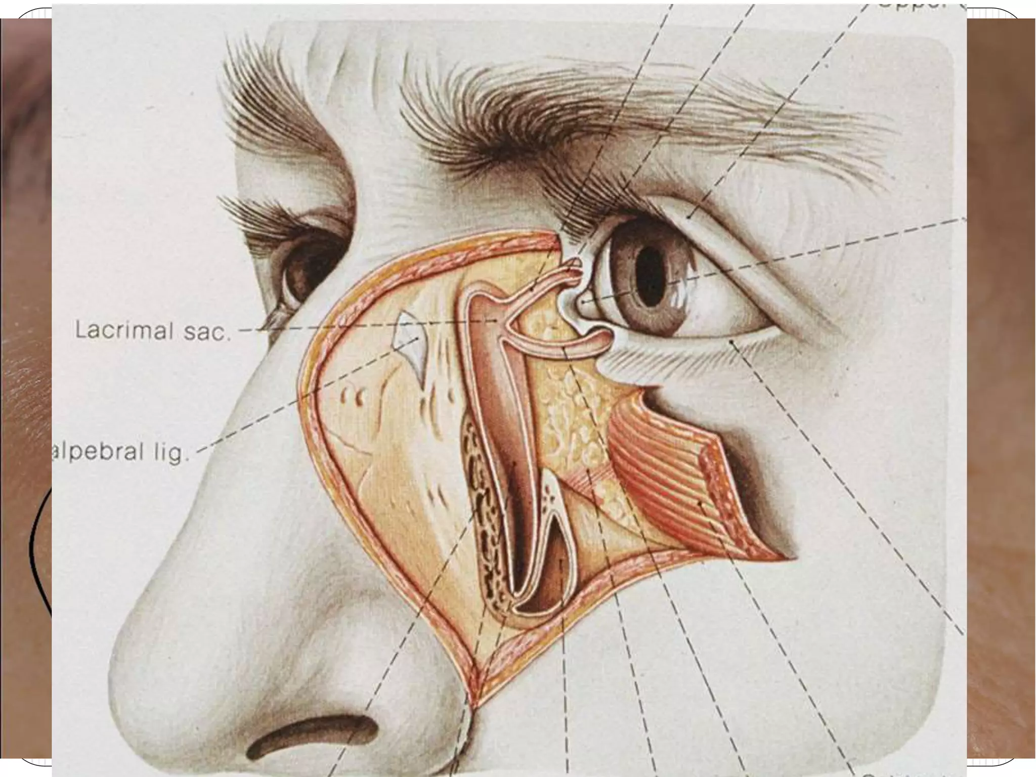clinical evalaution of Lacrimal system for undergraduate | PPT