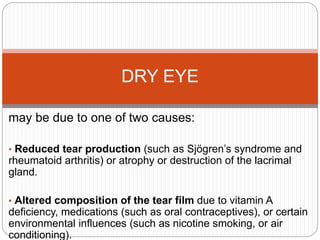 clinical evalaution of Lacrimal system for undergraduate | PPTX