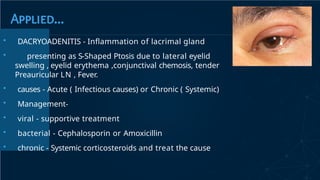 Anatomy of lacrimal apparatus.......pptx