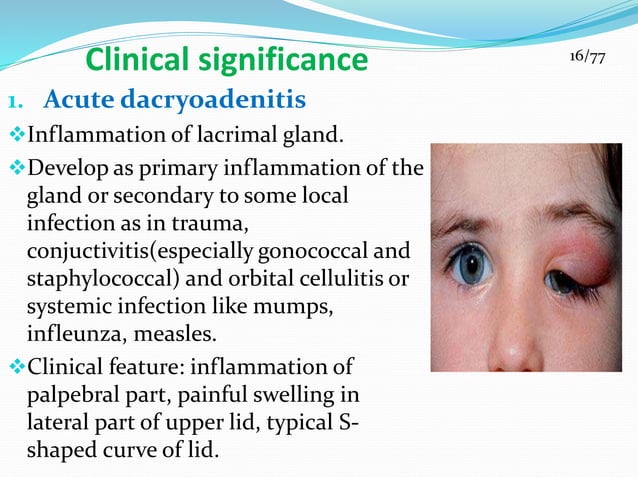 Lacrimal Apparatus: Different structure, Tear Film and Lacrimal Pump ...