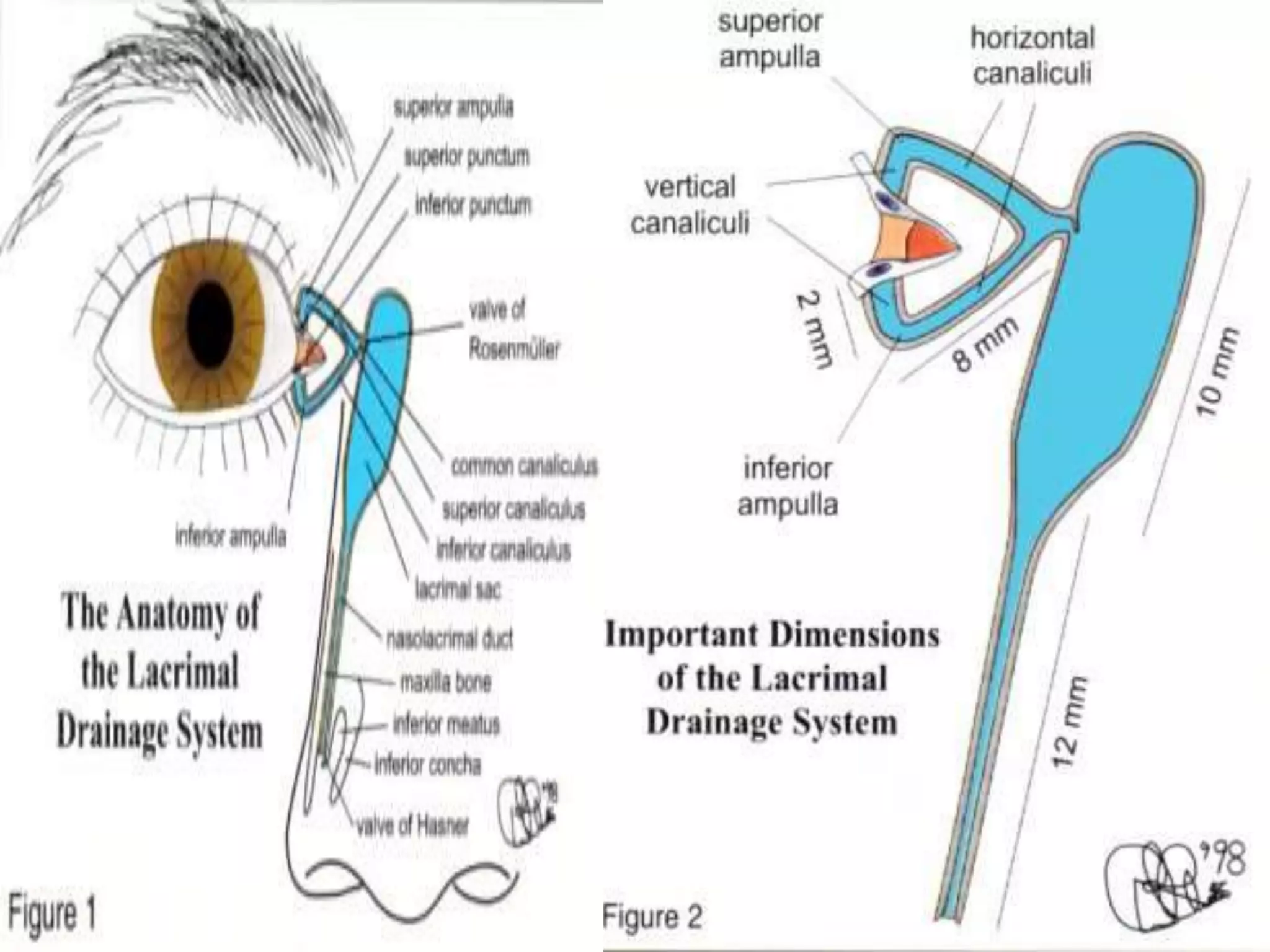 Lacrimal sac syringing | PPTX