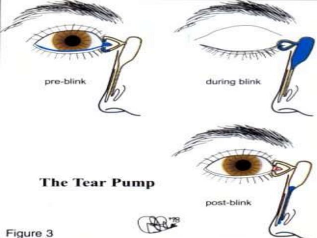 Lacrimal sac syringing | PPTX | Eye and Vision Conditions | Diseases ...