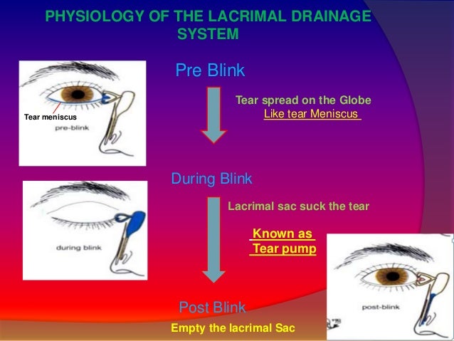 Lacrimal sac syringing