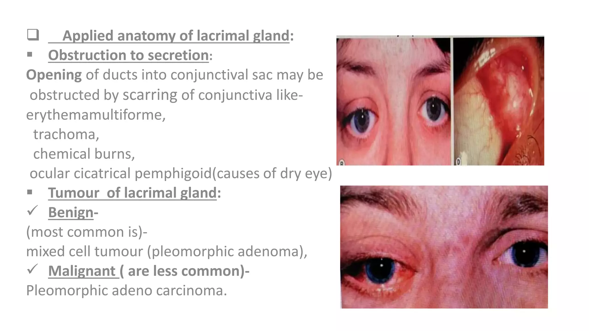 LACRIMAL APPARATUS.pptx
