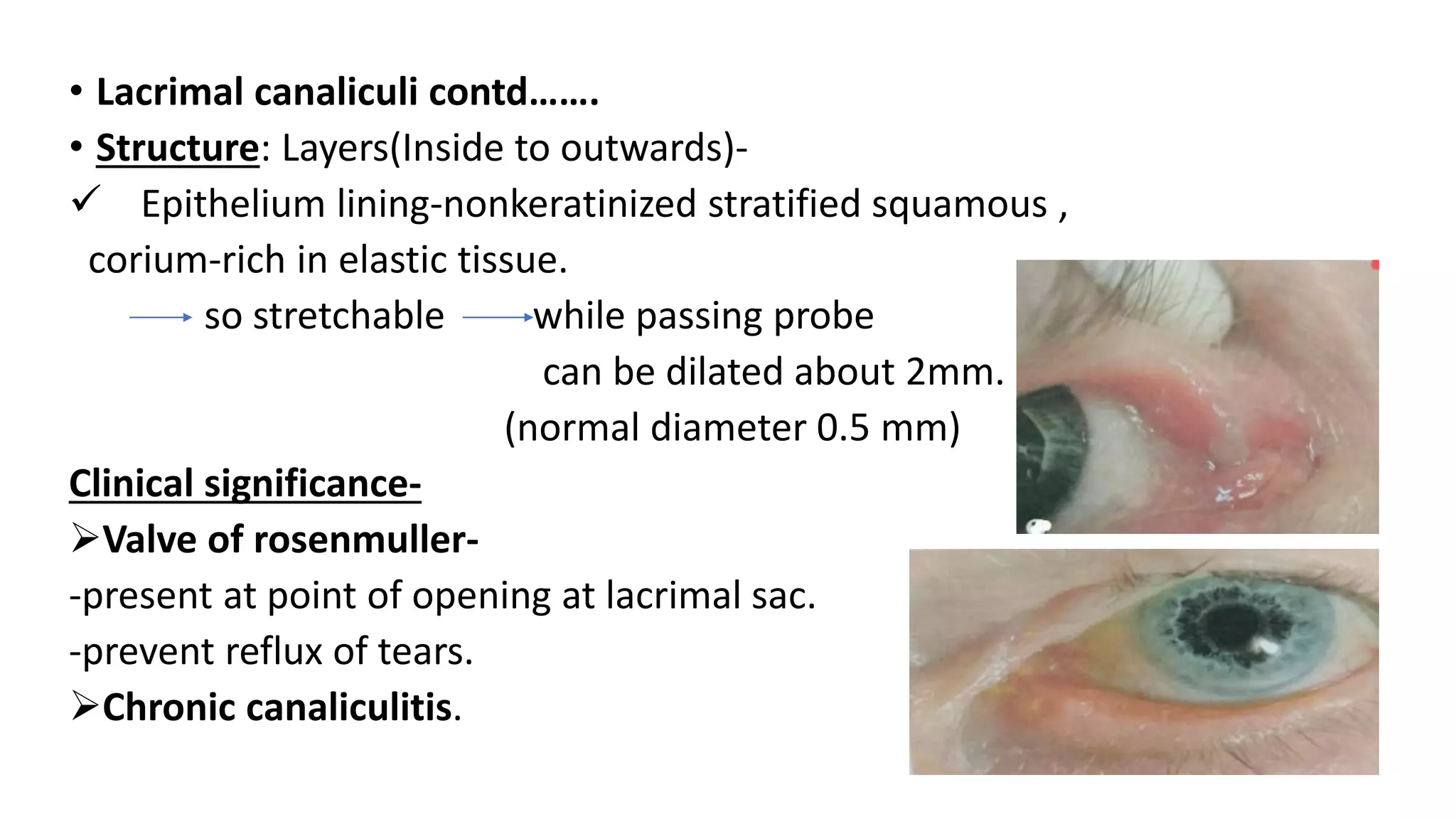 LACRIMAL APPARATUS.pptx