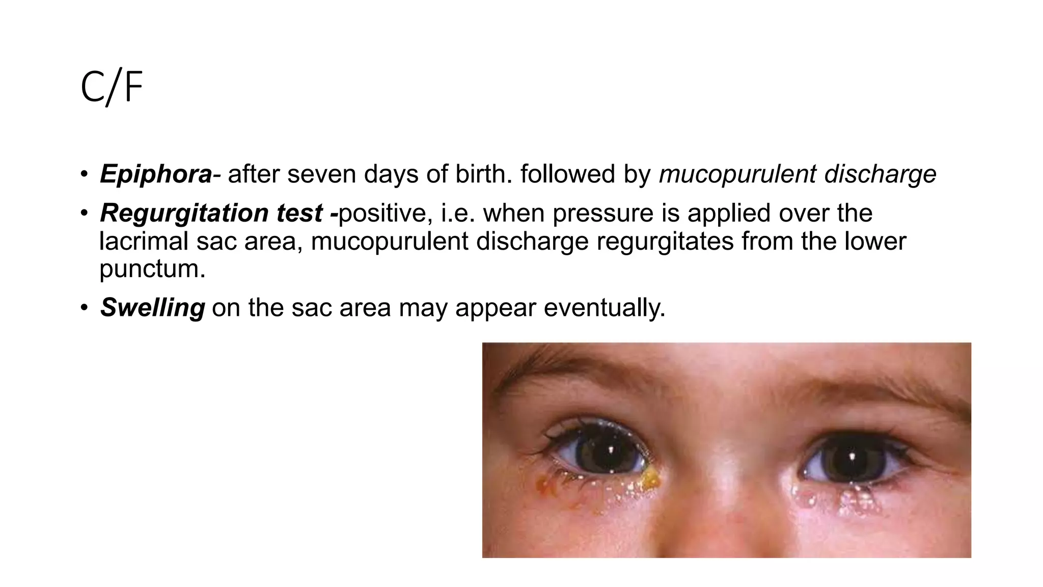lacrimal apparatus.pptx