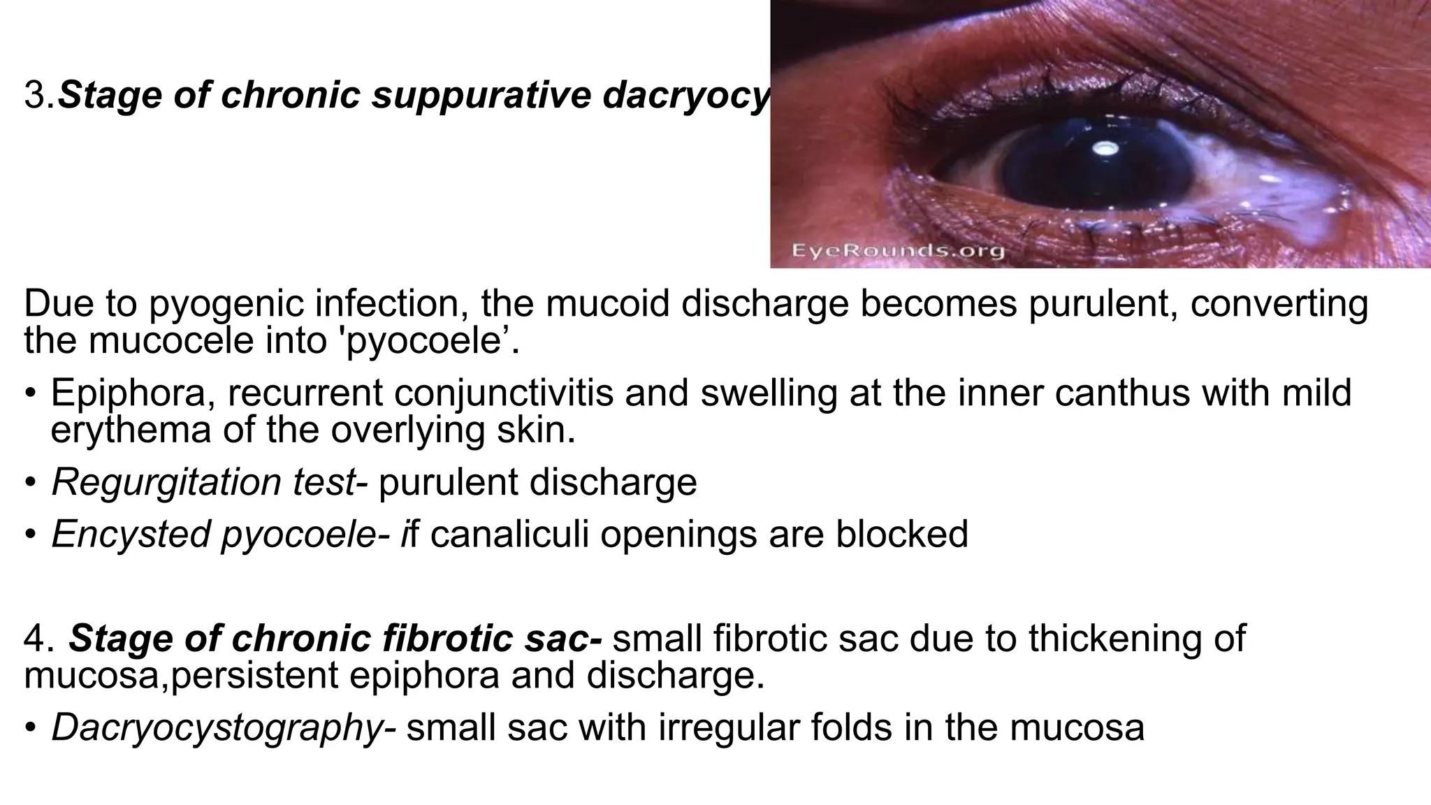 lacrimal apparatus.pptx