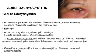 lacrimal apparatus.pptx
