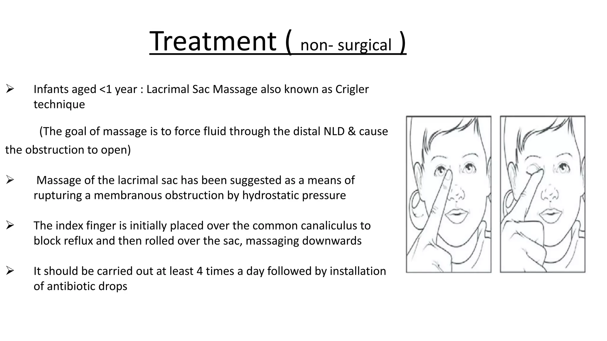 LACRIMAL APPARATUS- ANATOMY & PHYSIOLOGY | PPTX