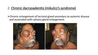 LACRIMAL APPARATUS- ANATOMY & PHYSIOLOGY | PPTX