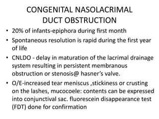 Lacrimal disorders in children | PPTX