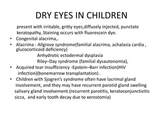 Lacrimal disorders in children | PPTX | Eye and Vision Conditions ...