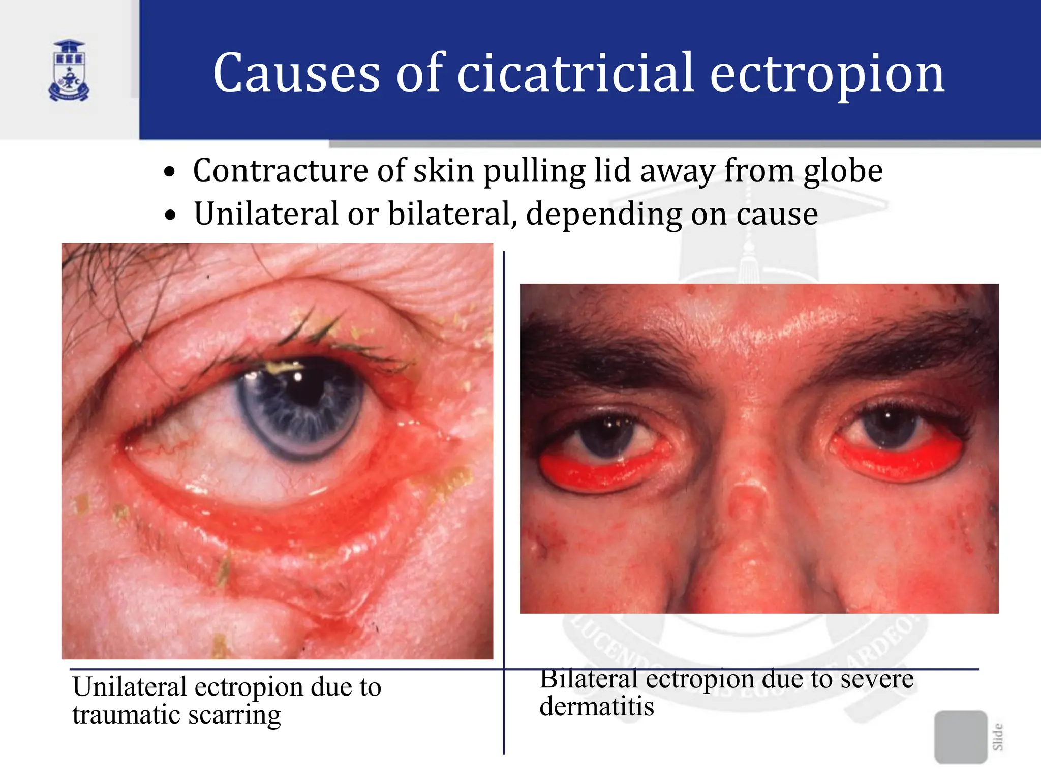 Lacrimal eyelids and conjunctivites_0.pdf