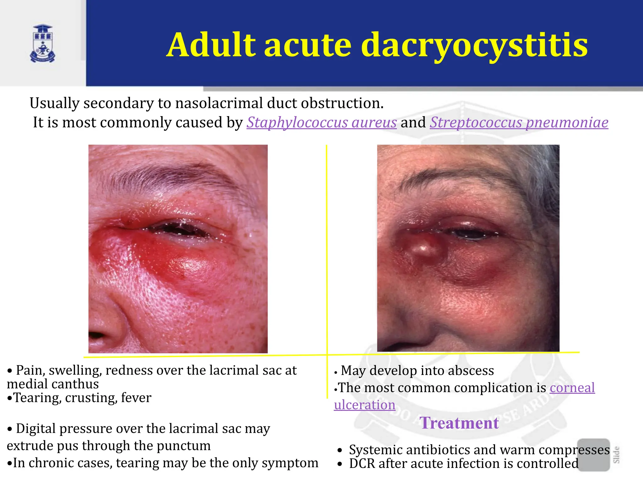 Lacrimal eyelids and conjunctivites_0.pdf