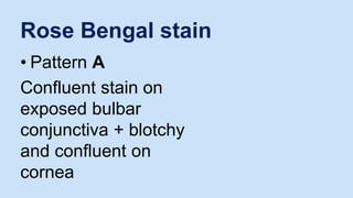 Lacrimal function tests.pptx