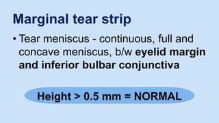 Lacrimal function tests.pptx