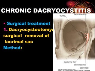 Lacrimal lecture pict by dr.abdul basir safi | PPT