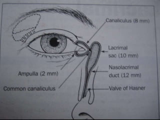 Lacrimal lecture pict by dr.abdul basir safi | PPT