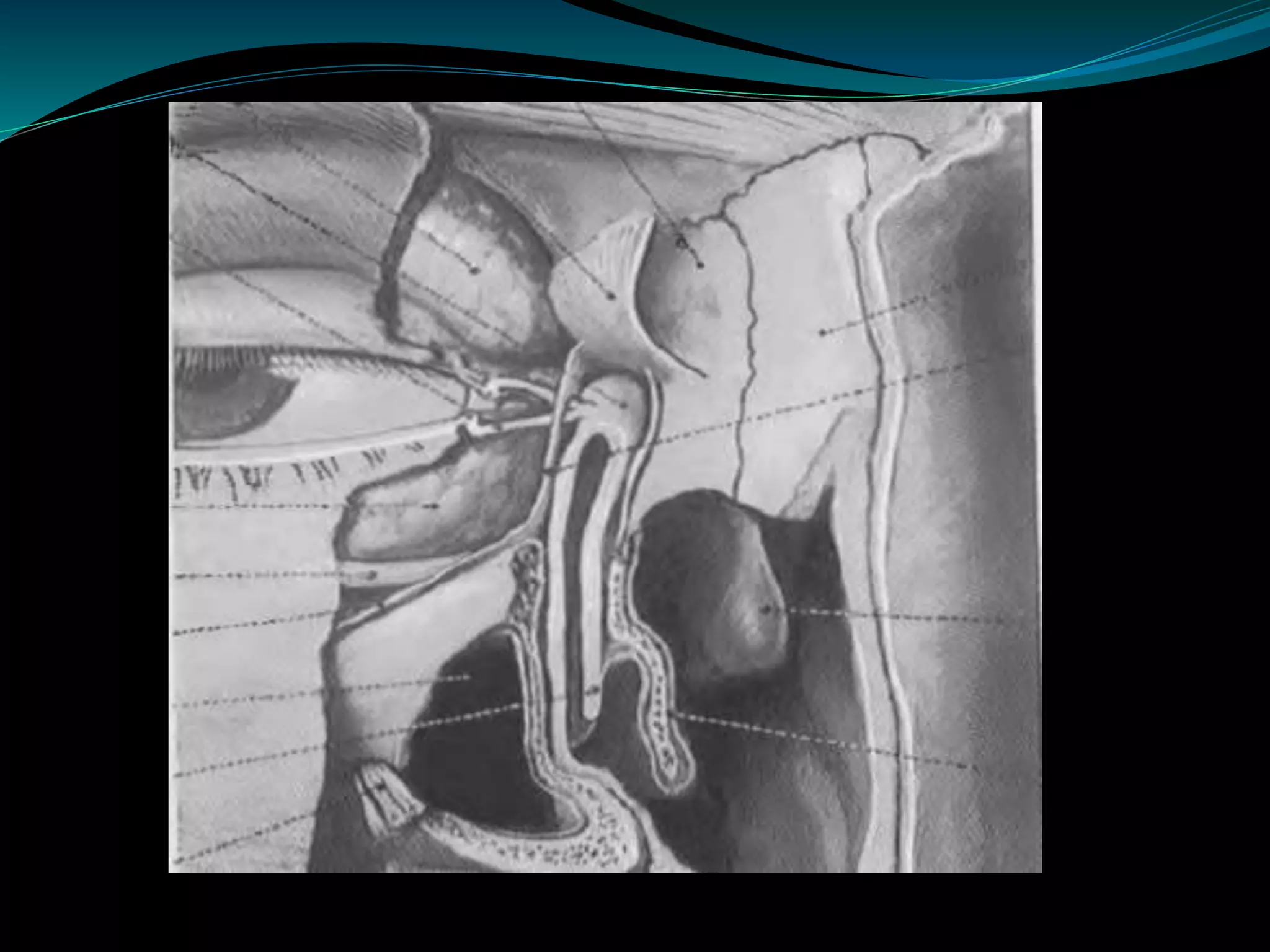 Lacrimal sac surgery | PPTX