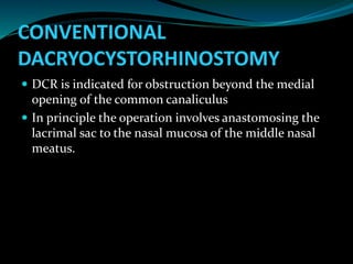 Lacrimal sac surgery | PPTX