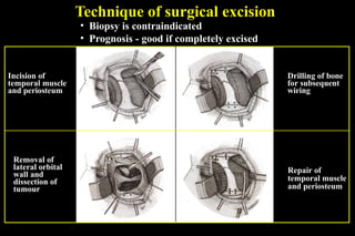 Lacrimal system2024 (1).pptx amran university | PPT