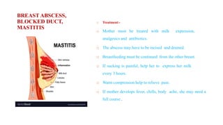 Lactation management | PPTX