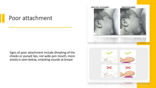lactation management in postpartum period.pptx