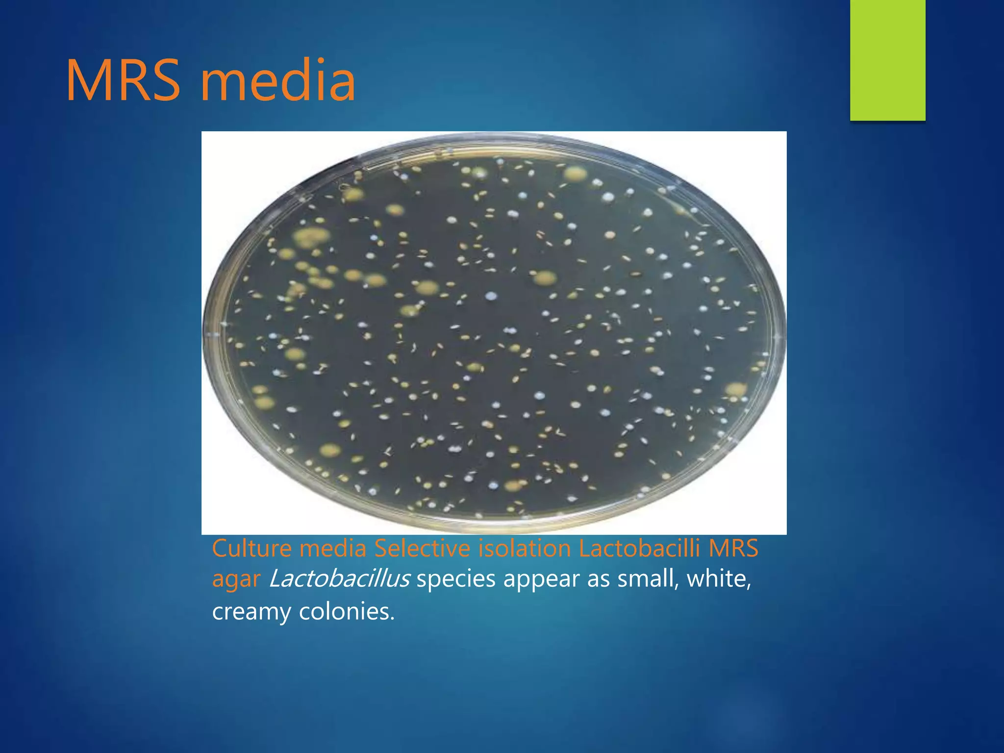 Microbiology :Lactobaciili and its impact in oral cavity | PPTX