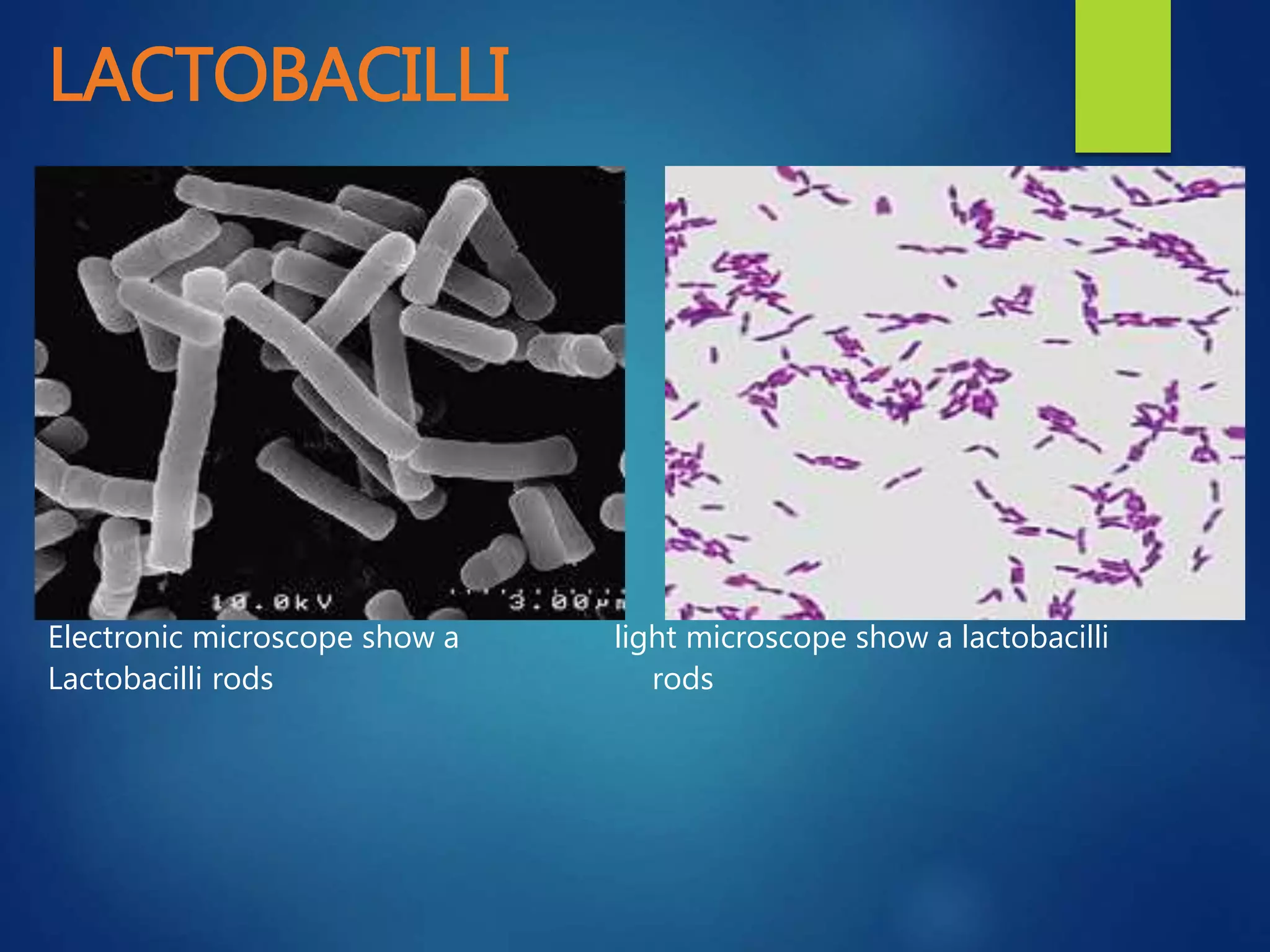 Microbiology :Lactobaciili and its impact in oral cavity | PPTX
