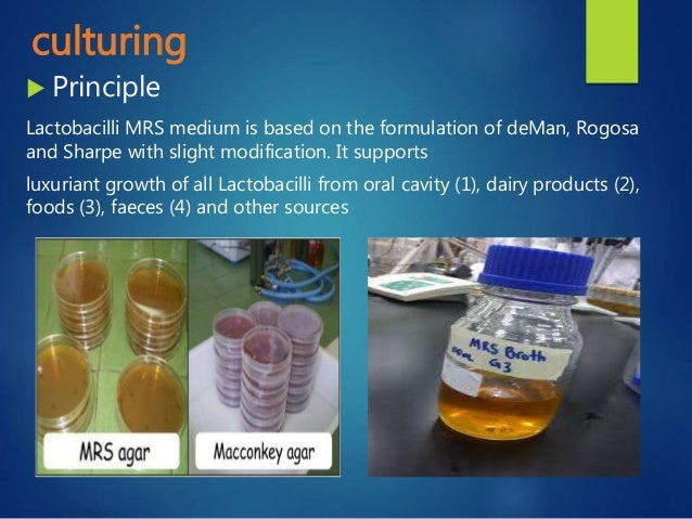 Microbiology :Lactobaciili and its impact in oral cavity