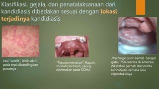 Lactobacillus acidophilus Sebagai Profilaksis Kandidiasis.pptx
