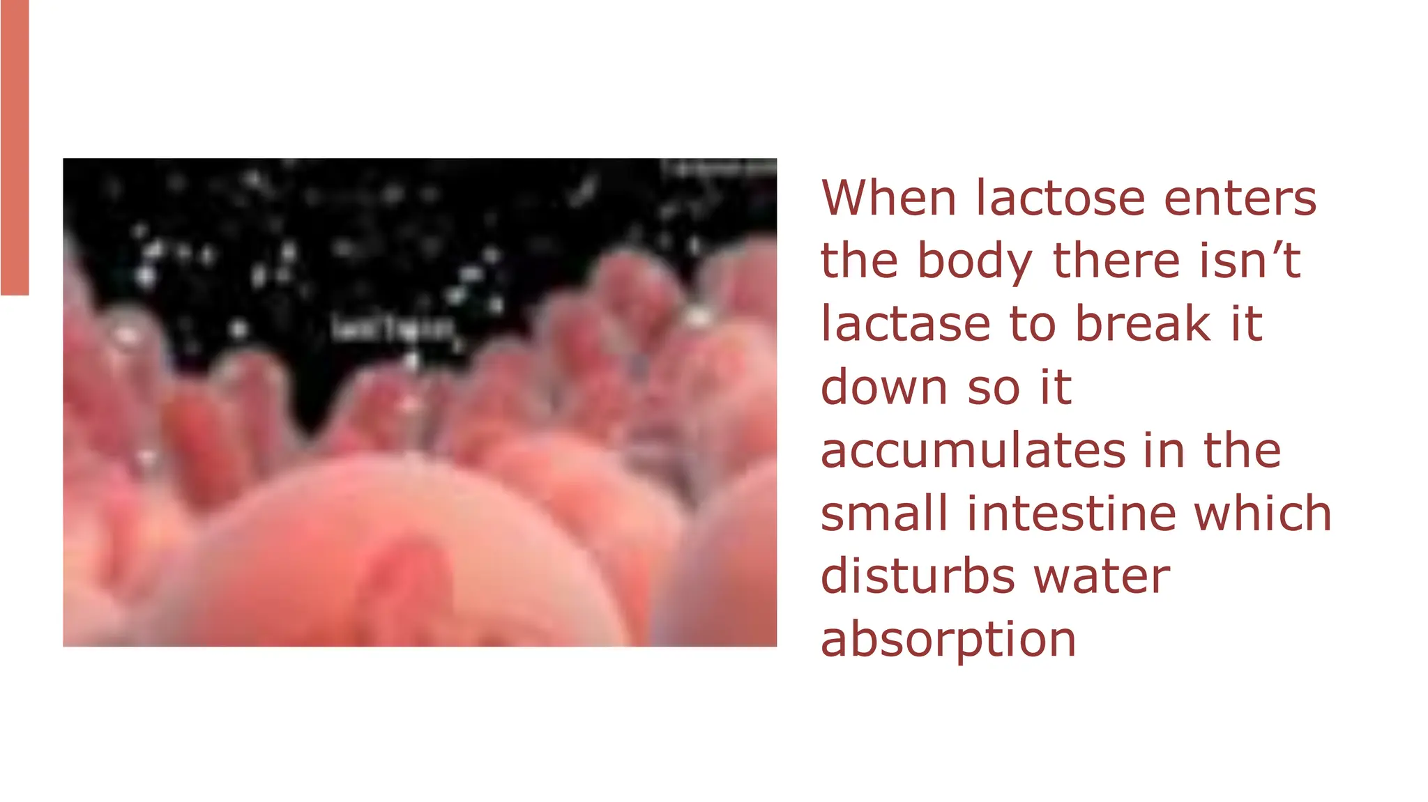 the Lactose Intolerance deficiency .pptx