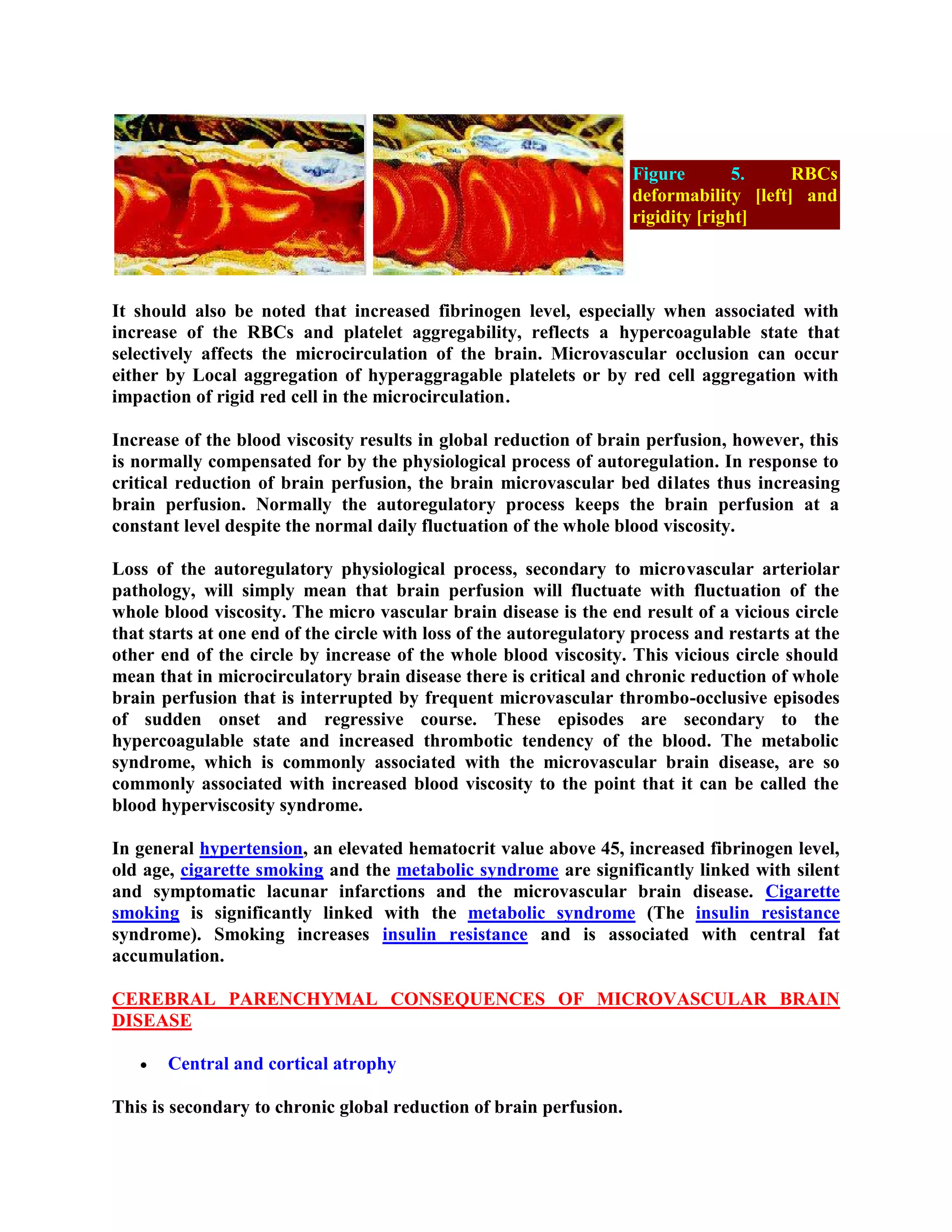 Radiological pathology of microvascular brain disease | PDF