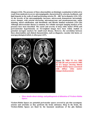 Radiological pathology of microvascular brain disease | PDF