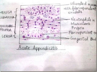 Appendix Histology Diagram
