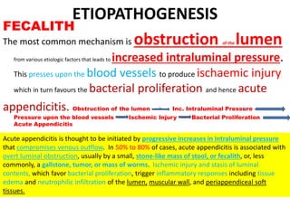 L acute appendicitis | PPT