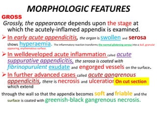 L acute appendicitis | PPT
