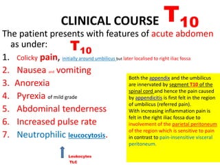 L acute appendicitis | PPTX