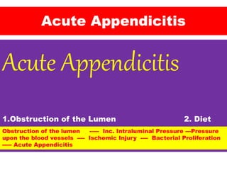 L acute appendicitis | PPTX