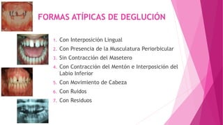 La deglucion | PPTX