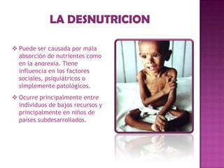 ¿Qué Es La Desnutrición Y Cuáles Son Sus Tipos? – FFDW