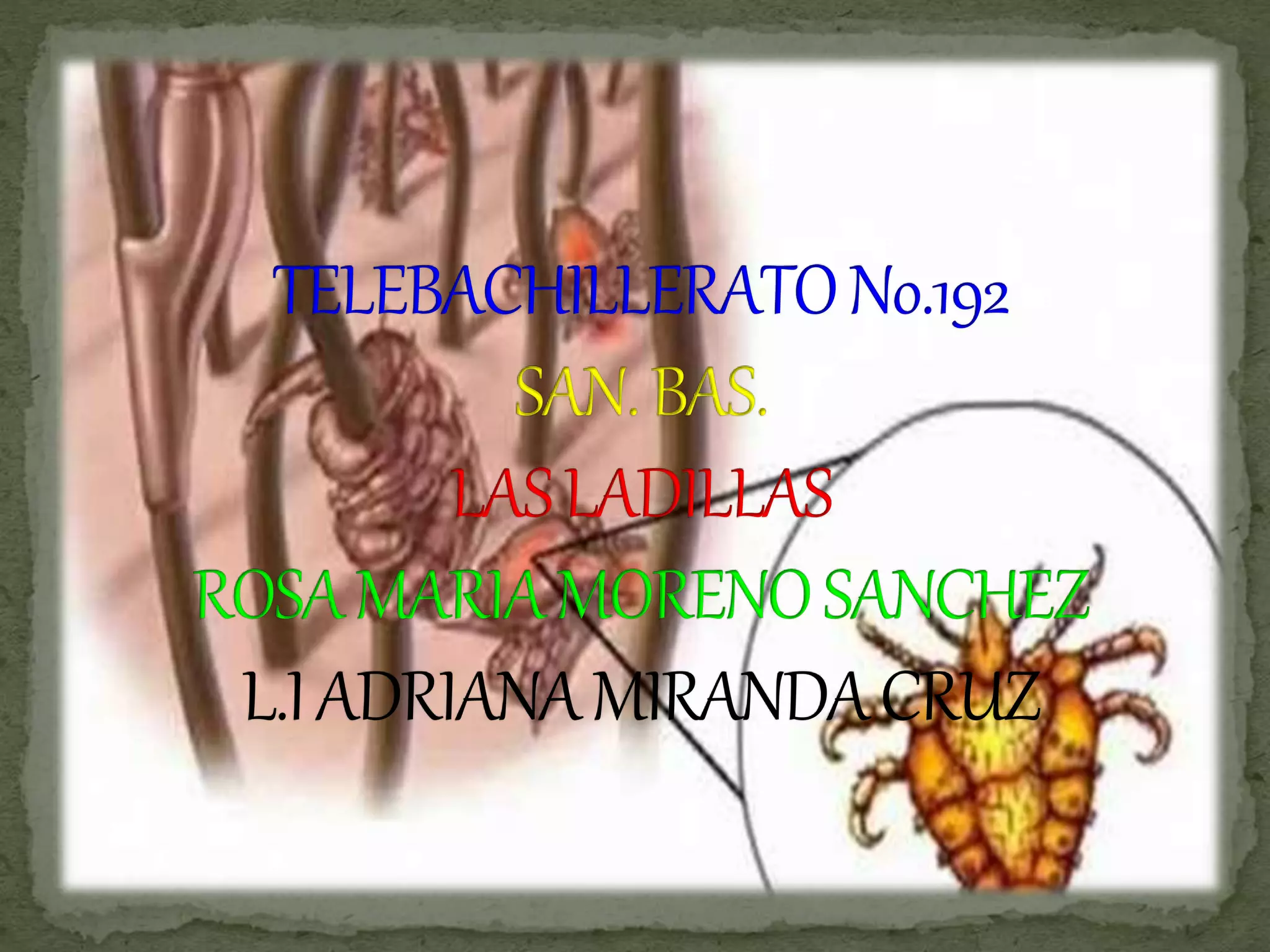 Ladillas | PPTX