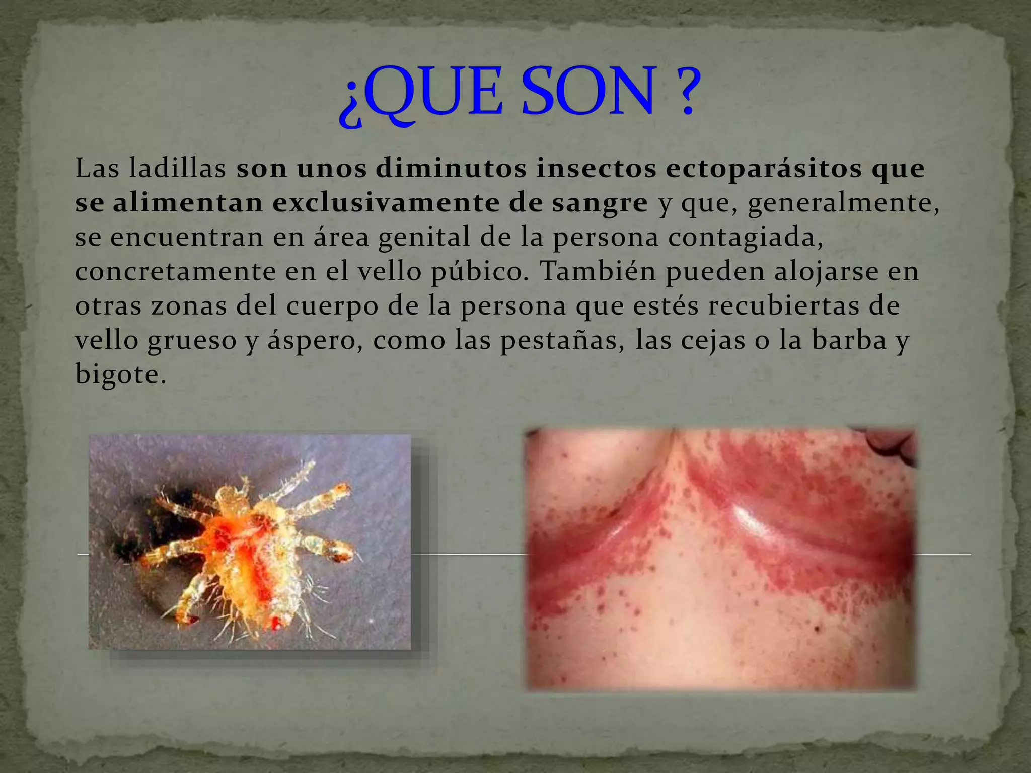 Ladillas | PPTX