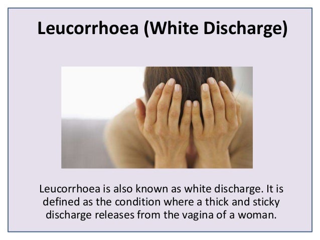Leucorrhea Treatment, Causes & Symptoms - White Discharge | Docto…